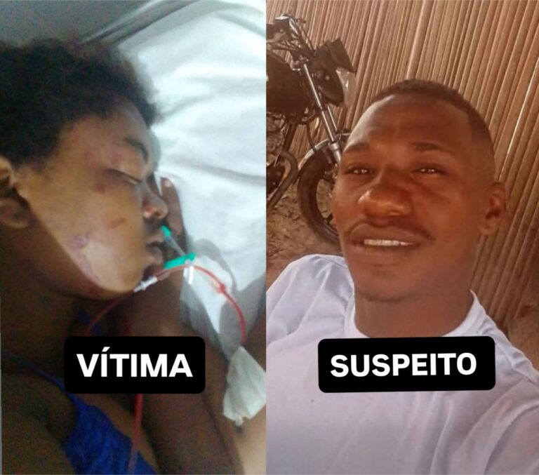 Adolescente fica gravemente ferida após ser atropelada por motociclista ...